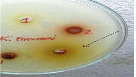 B The Arrow Showing The Antimicrobial Activity Of The