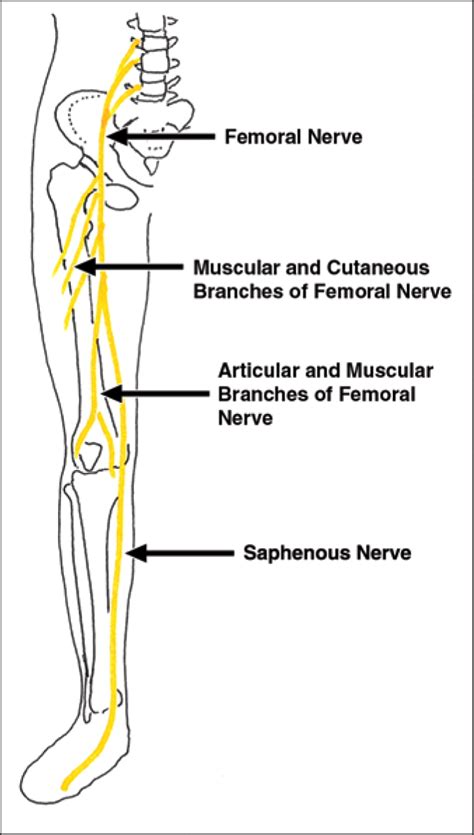 High Resolution 3 T Mr Neurography Of Femoral Neuropathy Ajr