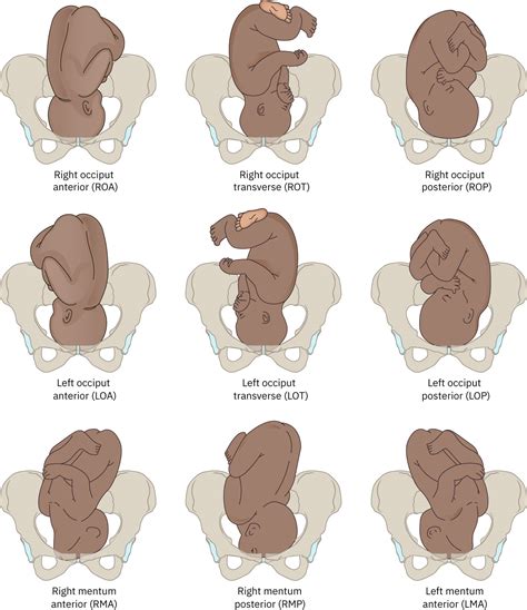 152 Factors Influencing The Process Of Labor And Birth Medicine Libretexts