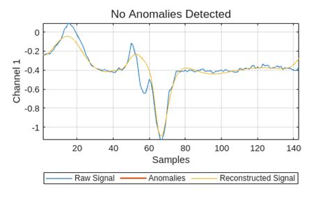 Detect Anomalies In Signals Using Deepsignalanomalydetector Matlab And Simulink