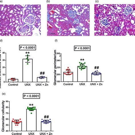 Ac Massons Trichrome Staining Of Renal Cortex And Interstitium