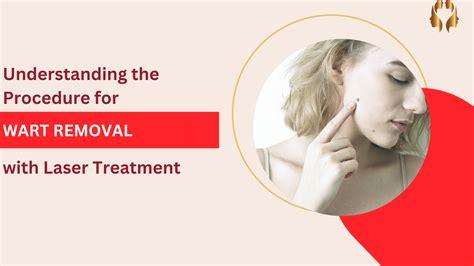 Circumcision Surgery In Chennai Rajcosmetic Surgery