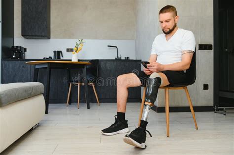 Man Amputee With Prosthetic Leg Disability On Above Knee Transfemoral