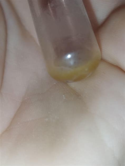 Removing Zeolite From Zeolite Tek Rcbeed