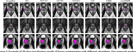 Figure 5 From Factorized Omnidirectional Representation Based Vision Gnn For Anisotropic 3d