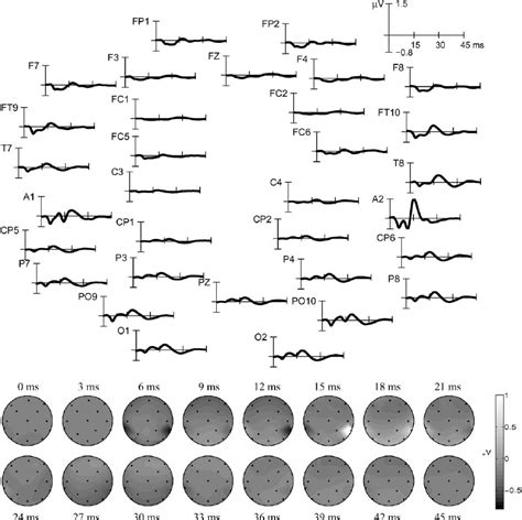 Measured Electric Potentials On The Scalp Of Subject Rh Shown In Single Download Scientific