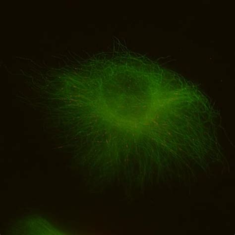 Cil31262 Homo Sapiens Epithelial Cell Renal Cell Carcinoma Cil