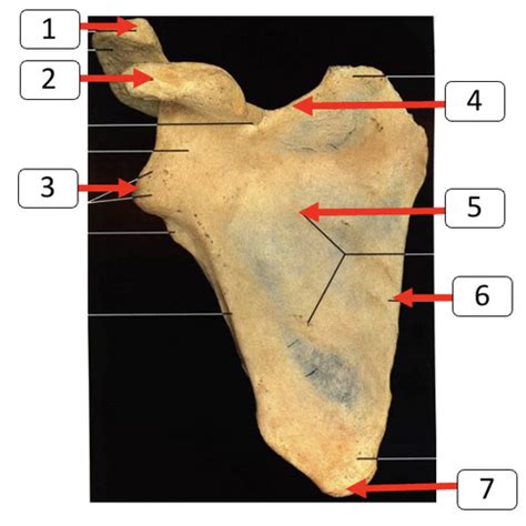 Flashcard Kb Os Scapula Aspectus Anterior Quizlet