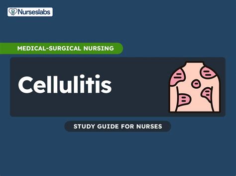 Cellulitis Icd 10