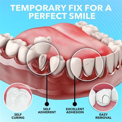 Jj Care Tooth Repair Kit Dental Care For Broken And Chipped Teeth