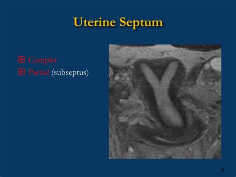 Ppt Hysteroscopic Septum Resection Powerpoint Presentation Free Download Id4681029