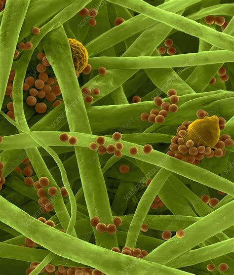 Hyphae And Sporangia Of Absidia Corymbifera Sem Stock Image C032 3178 Science Photo Library