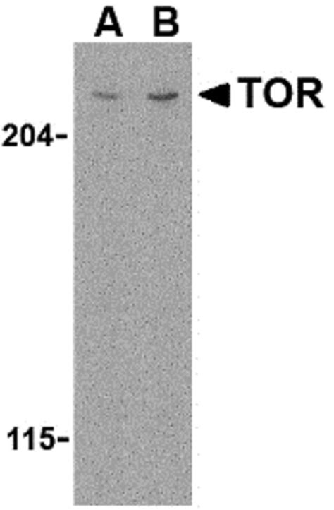 Anti Mtor Antibody Arg54675 Arigo Biolaboratories