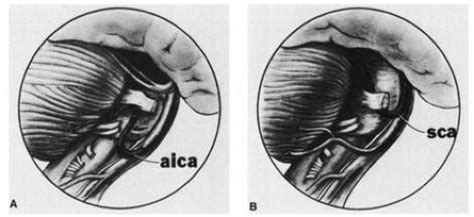 Trigeminal Nerve Ento Key