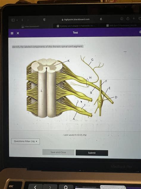 Solved Identify The Labeled Components Of This Thoracic