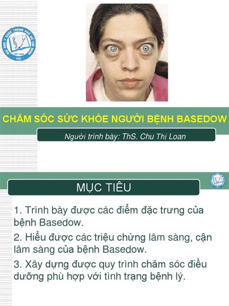 Bài Giảng Về Bệnh Basedow Pdf