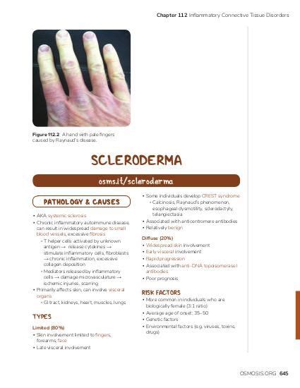 Scleroderma Osmosis