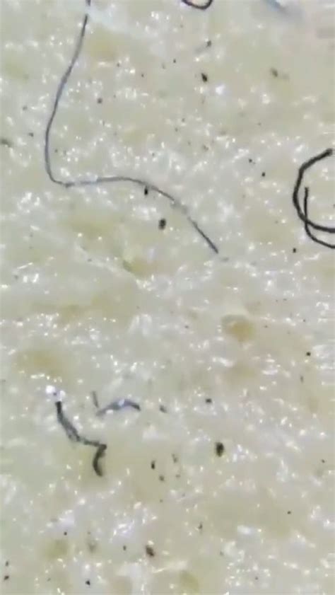 What Does It Look Like Under The Microscope What Does It Look Like Under The Microscope By