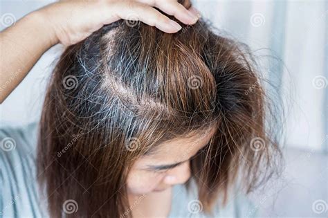 Closeup Of Woman With Thinning Hair Damaged Strands And Grey Roots