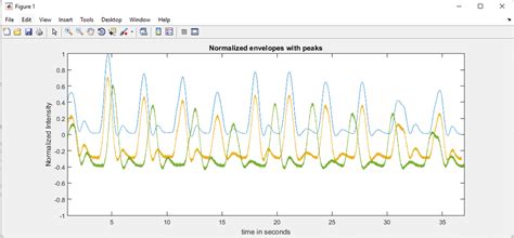 Github Ye Skydetecting Breathing And Snoring With Matlab