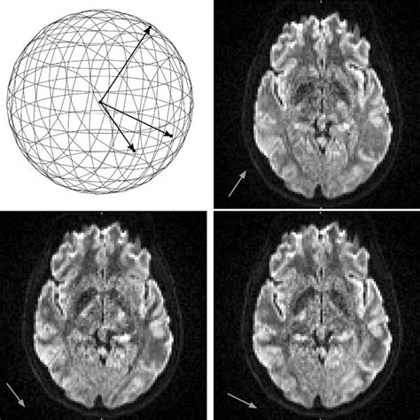 Illustration Of Three Diffusion Sensitizing Gradient Directions On A Download Scientific