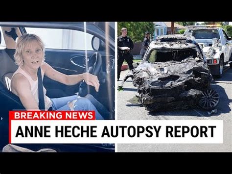 What Caused Anne Heches Fatal 90mph Car Crash Youtube
