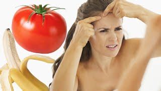 Pimple Hacks You Need To Try