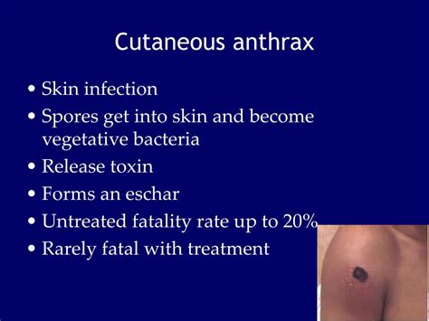 Ppt Anthrax Powerpoint Presentation Free Download Id7053312