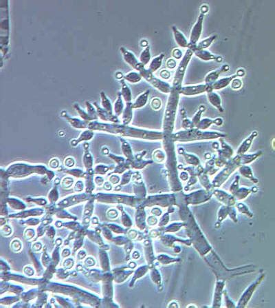 Trichoderma Viride En Citricos Tecnicoagricola Es