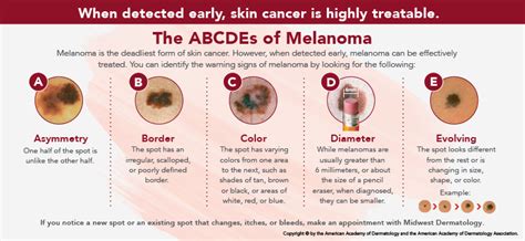 Melanoma Symptoms And Signs Extensive Guide Abcde The Skin Cancer