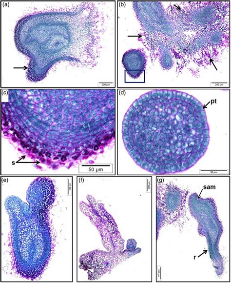 Histological Analysis Of Nodular Embryogenic Structures And Somatic