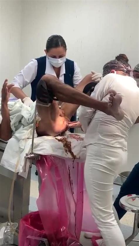 Surgery For A Dildo ThisVid Com