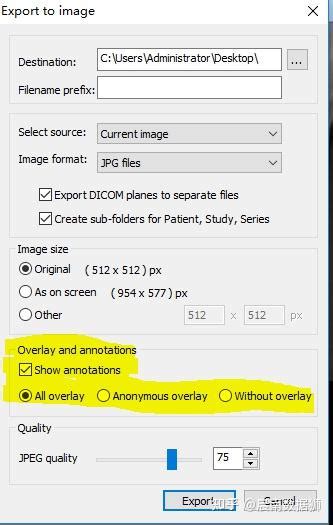 dcm文件怎么打开 知乎