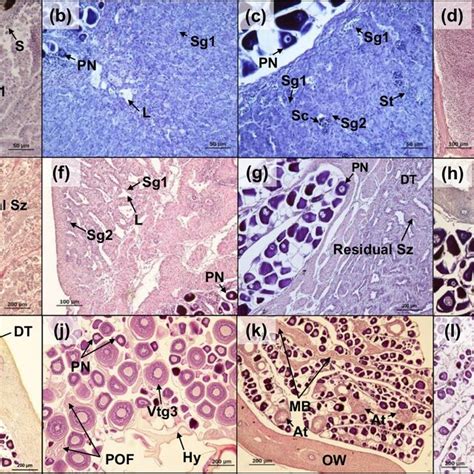 Transverse Sections Of Sagittal Otoliths With Annuli Indicated By White