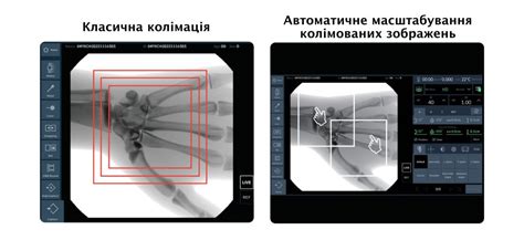 X Ray Fluoroscopic System Extron 7 C Arm Produced By Drtech Corp Republic Of Korea X Ray