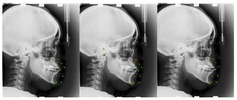 An Intelligent Shooting Reward Learning Network Scheme For Medical Image Landmark Detection