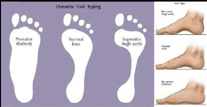 Three Different Types Of Human Foot Arch And Contact Area Of Each Type
