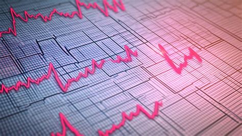 Detailed Perspective Of Ecg Monitor Graph Lines In Healthcare Stock
