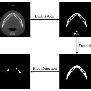 Illustration Of Two Types Of Abnormality A Close Border Lesion B Download Scientific
