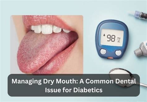 Managing Dry Mouth A Common Dental Issue For Diabetics