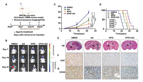 《theranostics》康春生组发表胶质瘤治疗重要文章