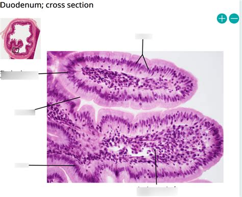 Duodenum Cross Section Diagram Quizlet