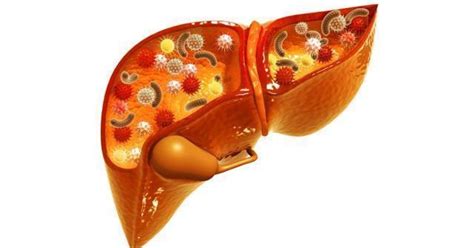 만성 간질환자에게 쓰지 않던 스타틴 알고 보니 더 효과적