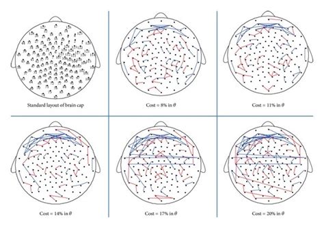 The Difference Connected Graphs In The Theta Band 4 7 Hz Between Ec Download Scientific