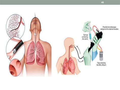 Pulmonary Function Test Pptx Lung And Respiratory Health Diseases