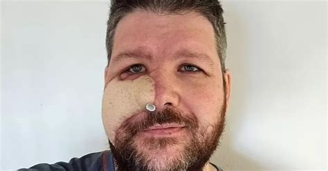 Man Whose Face Was Chewed Off By Bear Gets Ultimate Revenge By Turning It Into Kebabs The Mirror