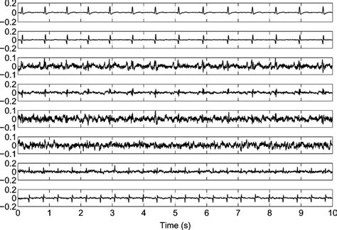 Periodic Components Extracted From The Dataset With Maternal And Fetal