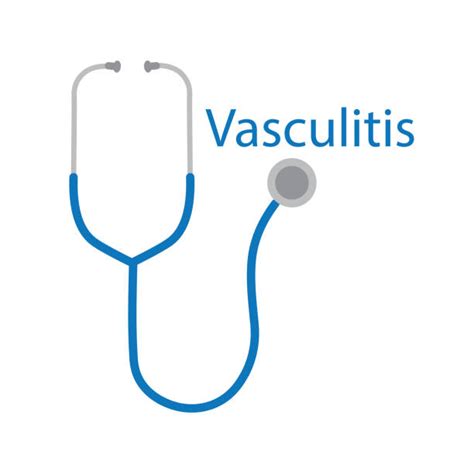 60 Vasculitis Stock Illustrations Royalty Free Vector Graphics And Clip