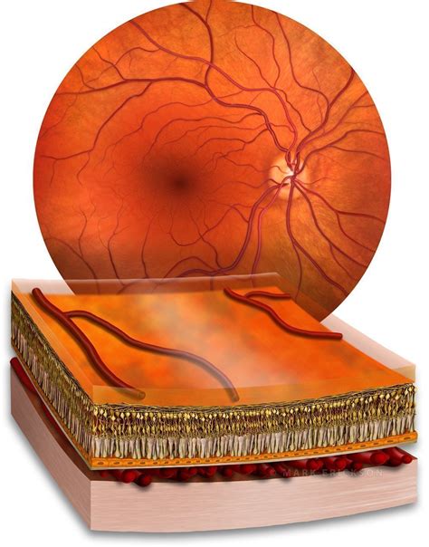 Retina Anatomy Schematic Cross Section Illustration Eye Art