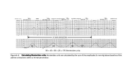 Case Files Obstetrics Gynecology Lecture Notesed 54387147 13 10 Min Window 50 45 50 25